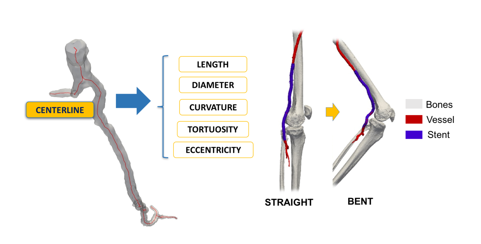 In-vivo morphological changes of the femoro-popliteal artery due to ...