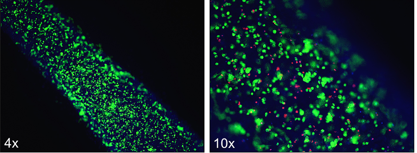 3D Model Muscle Fiber | Compmech