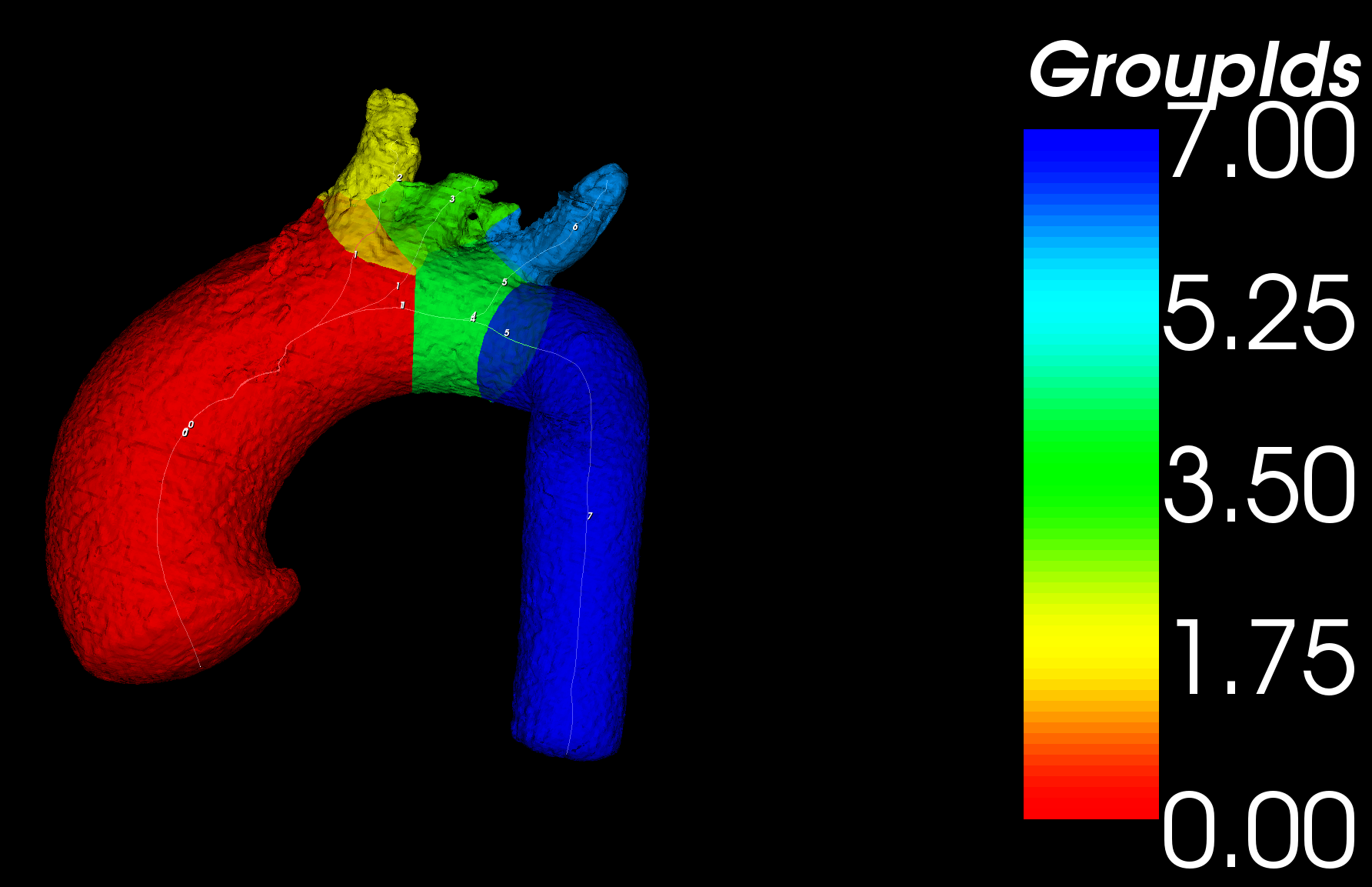 VTK/VMTK: vessel geometry extraction | Compmech