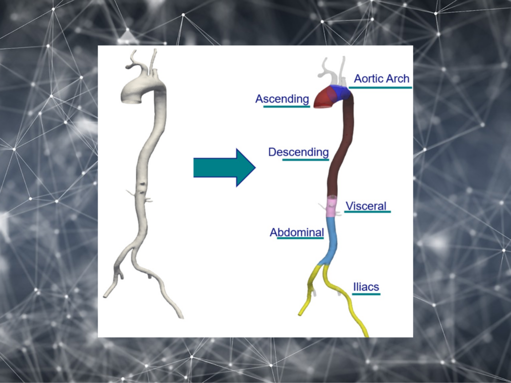 CFD analysis of transcatheter aortic root replacement | Compmech