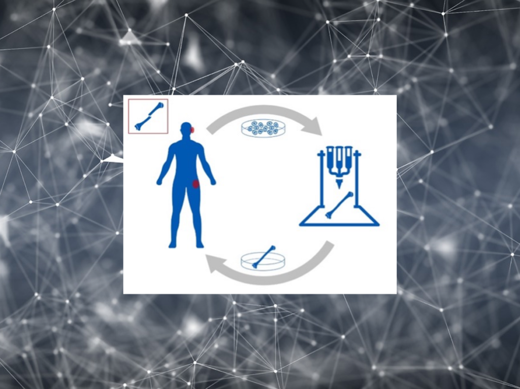 3D printing polycaprolactone and hydroxyapatite | Compmech